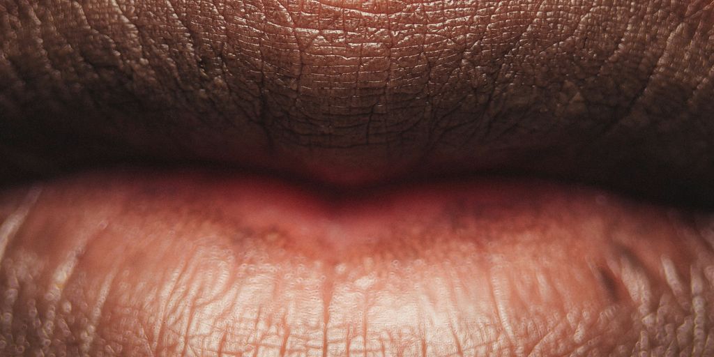 Uncovering the Link Between Vitamin Deficiency and Dry Lips